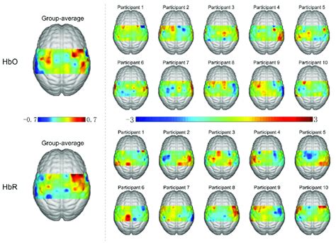 The Spatial Patterns Of Resting State Ics With Highest Lateralization