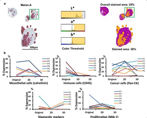 Quantification Of Ihc Staining A Digitalised Image Analysis Approach