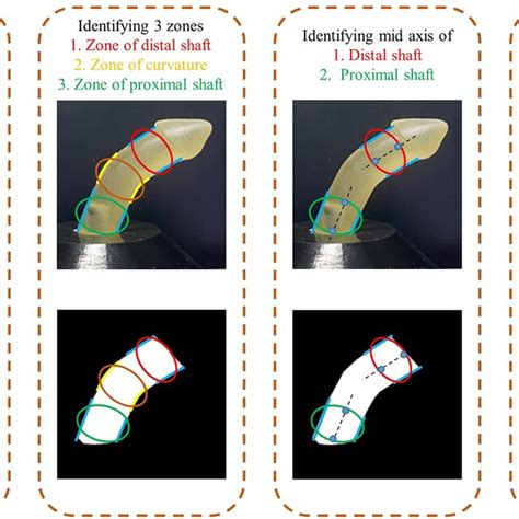 Identifying Four Key Points Of The Penile Shaft On Cropped Image And Download Scientific
