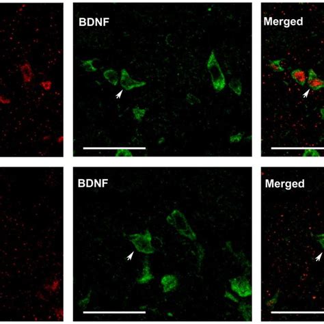 Double Immunofluorescence Staining Of P300creb Binding Protein Cbp