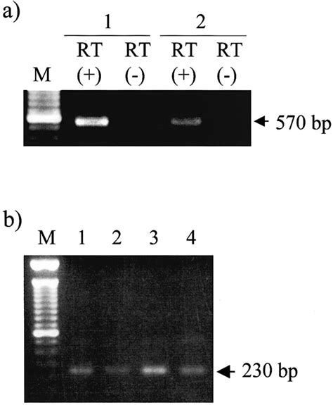 A Slpi Mrna Expression In The Fallopian Tube Agarose Gel