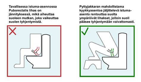 Maudsleyn Menetelmä Syömishäiriöiden Perhepohjainen Hoito Usein