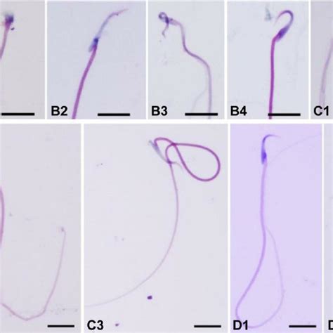 Morphological Classification Of Rat Epididymal Sperm Normal Sperm A