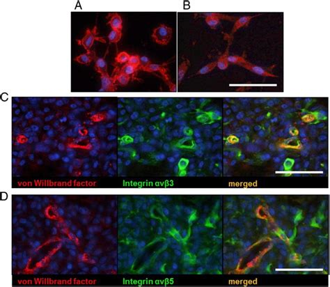 Expression Of Integrins αvβ3 And αvβ5 In The Glioma Cell Line U87Δegfr