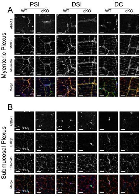 NcRNA Free Full Text Sequencing Reveals MiRNAs Enriched In The