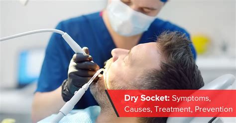 Dry Socket Symptoms Causes Treatment Prevention