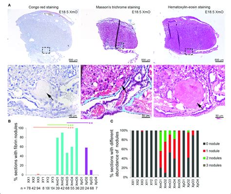 Identifications And Quantification Of Fibrin Deposits In Term