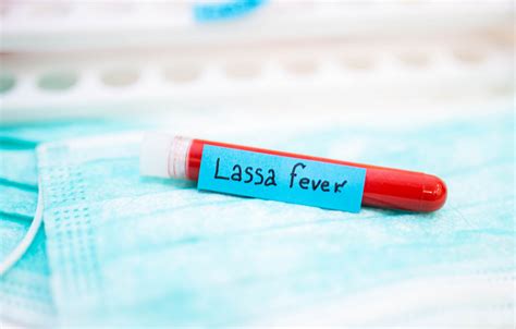 Death Toll Of Lassa Fever Rises To 171 In Nigeria Health News Et
