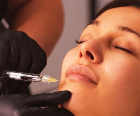 What Is A Lip Flip Procedure Cost And Potential Complications