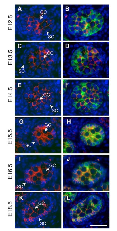 Expression Pattern Of β Catenin In The Developing Testis A L Download Scientific Diagram