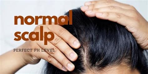 How To Check Scalp Type Understanding Your Scalp Type Scalp Care And