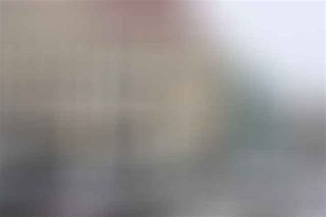 Understanding Scotoma An In Depth Examination Of Visual Field Loss