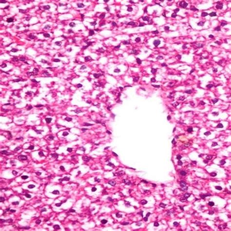 Section In Hepatic Tissue Treated With Cadmium Selenium After 6