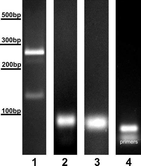 Representative Photographs Of Rt Pcr Products Two Isoforms Of Vegf A