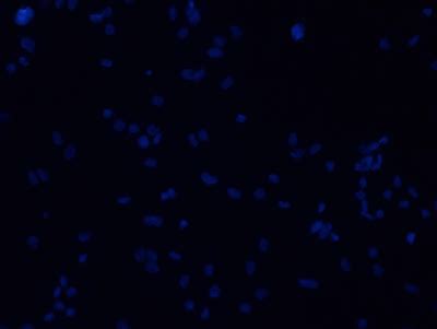 阿簡生物筆記 以imagej的macro實作GUI進行重疊細胞的分割