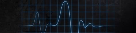 syafiq ishamuddin on linkedin in machine learning overfitting and