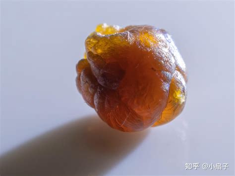 肾结石 尿路结石3天排出 附高清无码微距大图 慎入 知乎