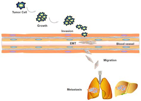 Molecules Free Full Text The Role Of Foxp3 On Tumor Metastasis And