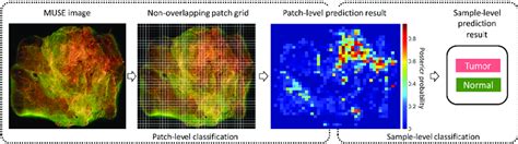 The Process For Margin Level Binary Prediction Tumor Vs Normal A Download Scientific