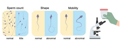 What Is Semen Analysis BeatCancer