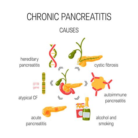 Pancreatitis Illustrations Royalty Free Vector Graphics And Clip Art