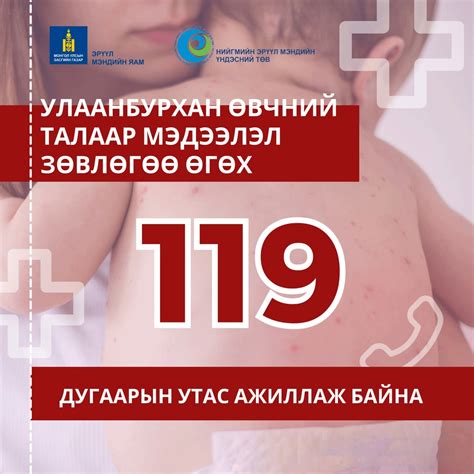 👉Иргэн та улаанбурхан Орхон аймгийн Эрүүл мэндийн газар Facebook