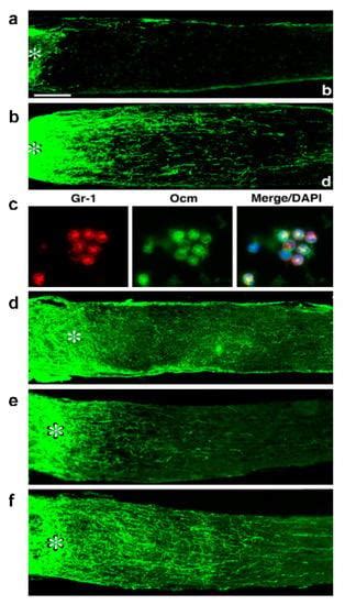 Kimberly Wong على Linkedin Retinal Ganglion Cell Survival And Axon