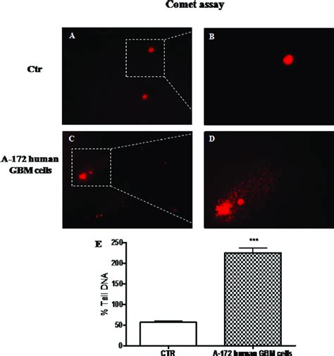 The Role Of Dna Damage In Gbm Human Cell Lines Comet Assay On Gbm