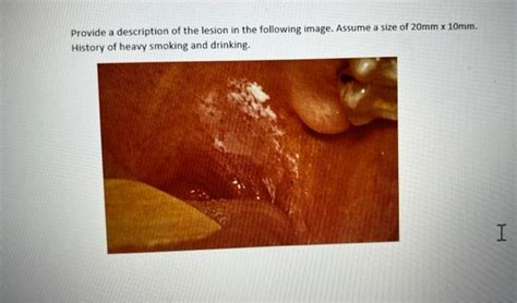 Solved Provide A Description Of The Lesion In The Following