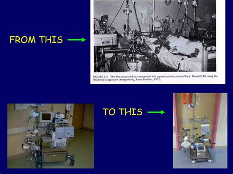 Ppt Ecmo Powerpoint Presentation Free Download Id 7343122