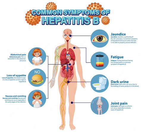 Premium Vector Informative Poster Of Common Symptoms Hepatitis B