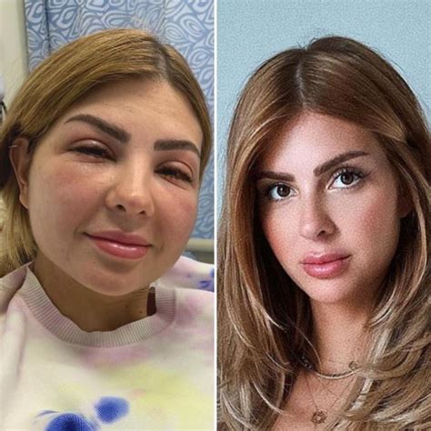 تغيير كبير بملامح وجه لينا قزيز غالباً ما منكون مهووسين أنو نصير أجمل