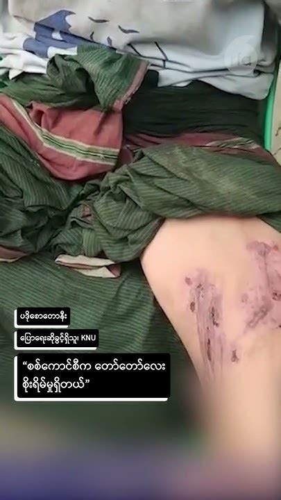 စစ်ကောင်စီကြောင့် နှစ်လအတွင်း အရပ်သား ၇၀ ကျော် သေဆုံး Youtube