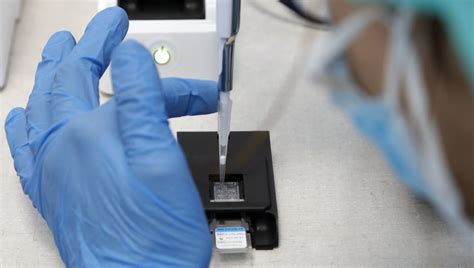 Coronavirus Il Bollettino Di Oggi 7 Dicembre Aggiornamento Sui Casi