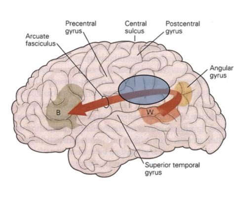 3 8 24 Language And Hemispheric Lateralization Flashcards Quizlet