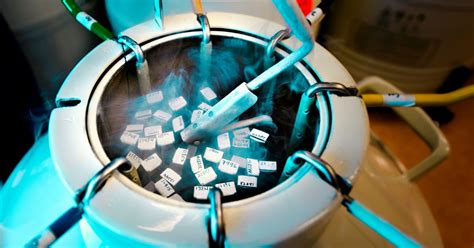 Freezing Sperm Cost Effectiveness And More