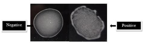 How To Perform Latex Agglutination Test Fully Explained