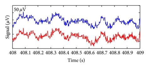 A Power Spectrum Of The Scalp Potential Of Figure 9a After Download Scientific Diagram