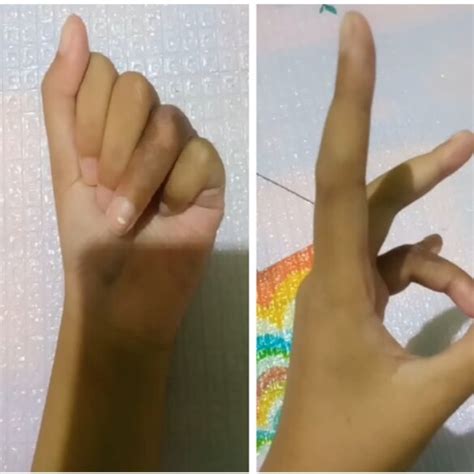 Postoperative Improvement In Functional Movement Of The Pip Joint Of