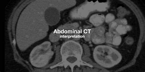 Abdominal Ct Reporting • Litfl • Radiology Library