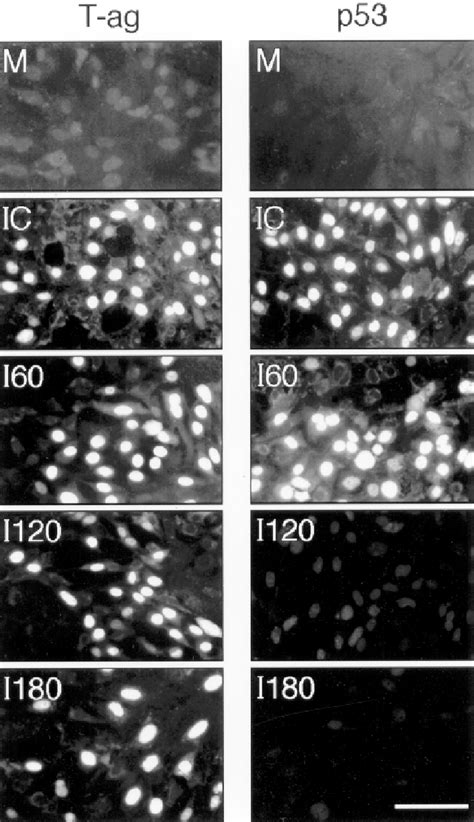 Immunofluorescence Staining Of T Antigen And P53 In Sv40 Infected