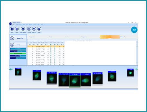 Spermatozoa Results Ht Casa