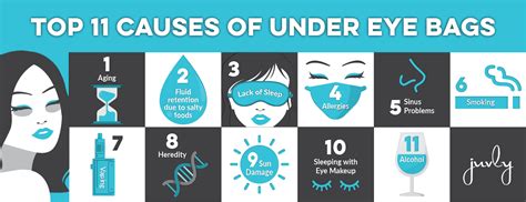 What Causes Bags Under Your Eyes 59 Personalized Wedding Ideas We Love