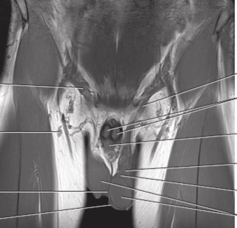 Male Pelvis Diagram Quizlet