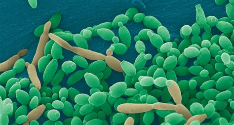 Gut Fungi Might Be Linked To Obesity And Inflammatory Bowel Disorders