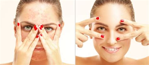 A Few Tips That Will Help You Avoid Makeup Allergies Women Daily Magazine