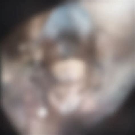 Understanding Pancreatic Cysts Causes And Treatments