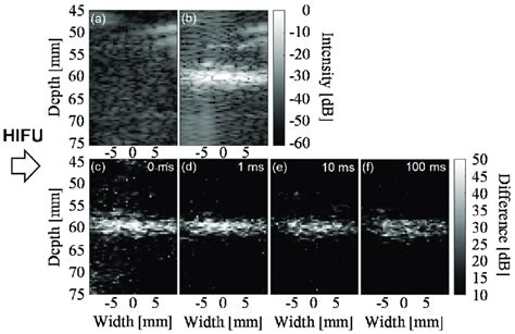 high speed pulse inversion pi images with two plane wave