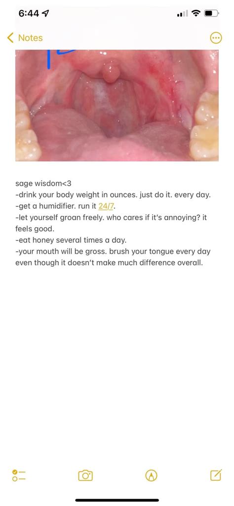 My Tonsillectomy Recovery Daily Photos Included 48 Days Post Op R