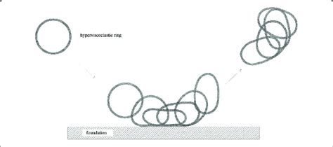 Sequence Of The Deformed Hyper Elastic Ring Before During And After